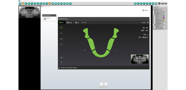 Software DEXIS™ Imaging Suite | DEXIS